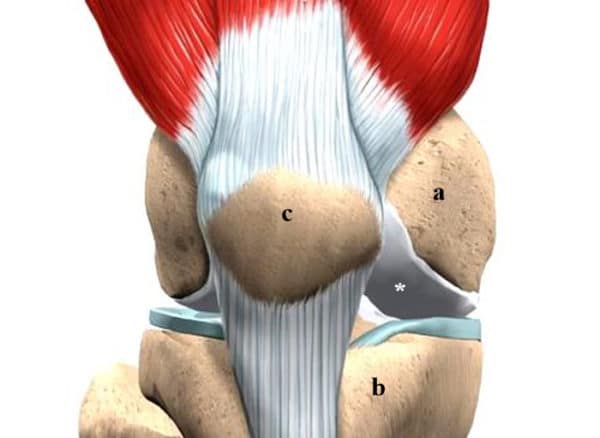 Artrosis de rodilla, información, diagnóstico y tratamientos