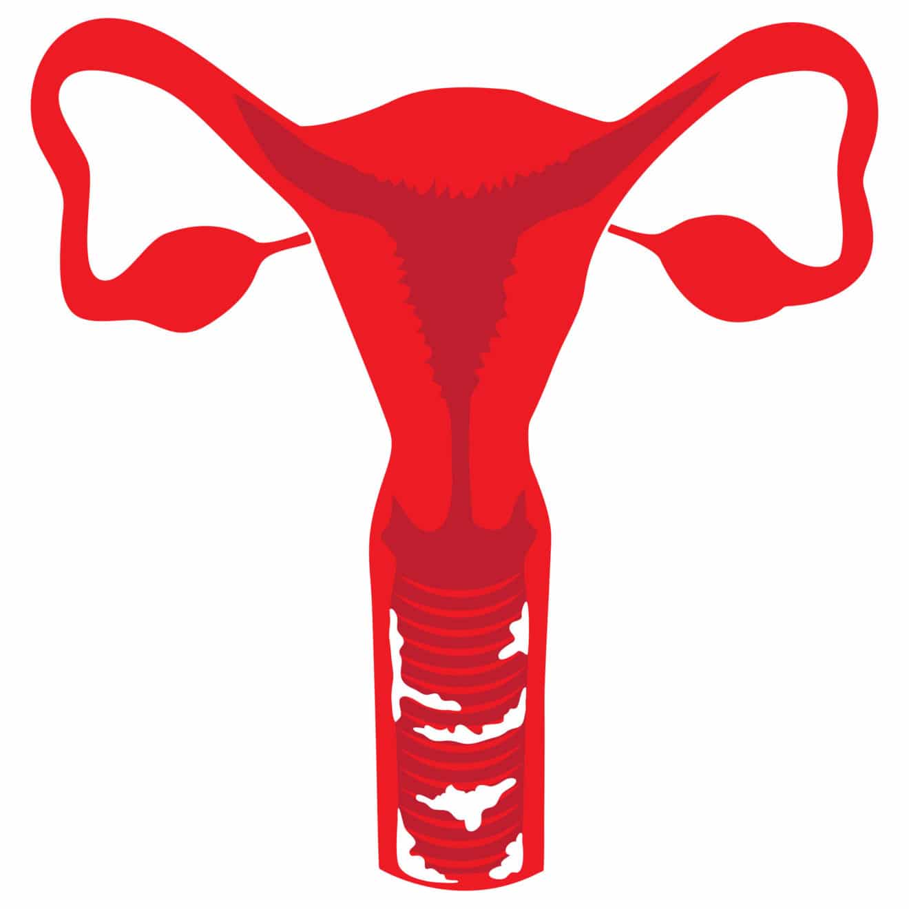 hongo candida - Actitud Saludable