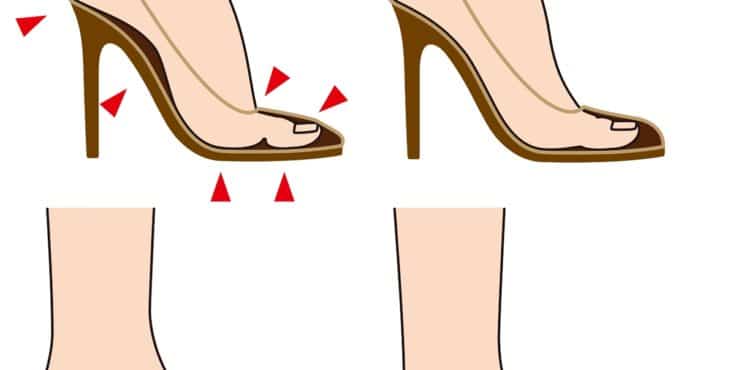 ¿Cuáles son las principales causas del dolor de talón?