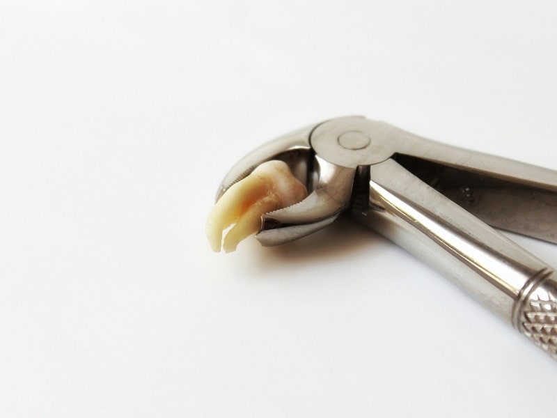 órganos-de-los-que-puedes-prescindir-4 - Actitud Saludable